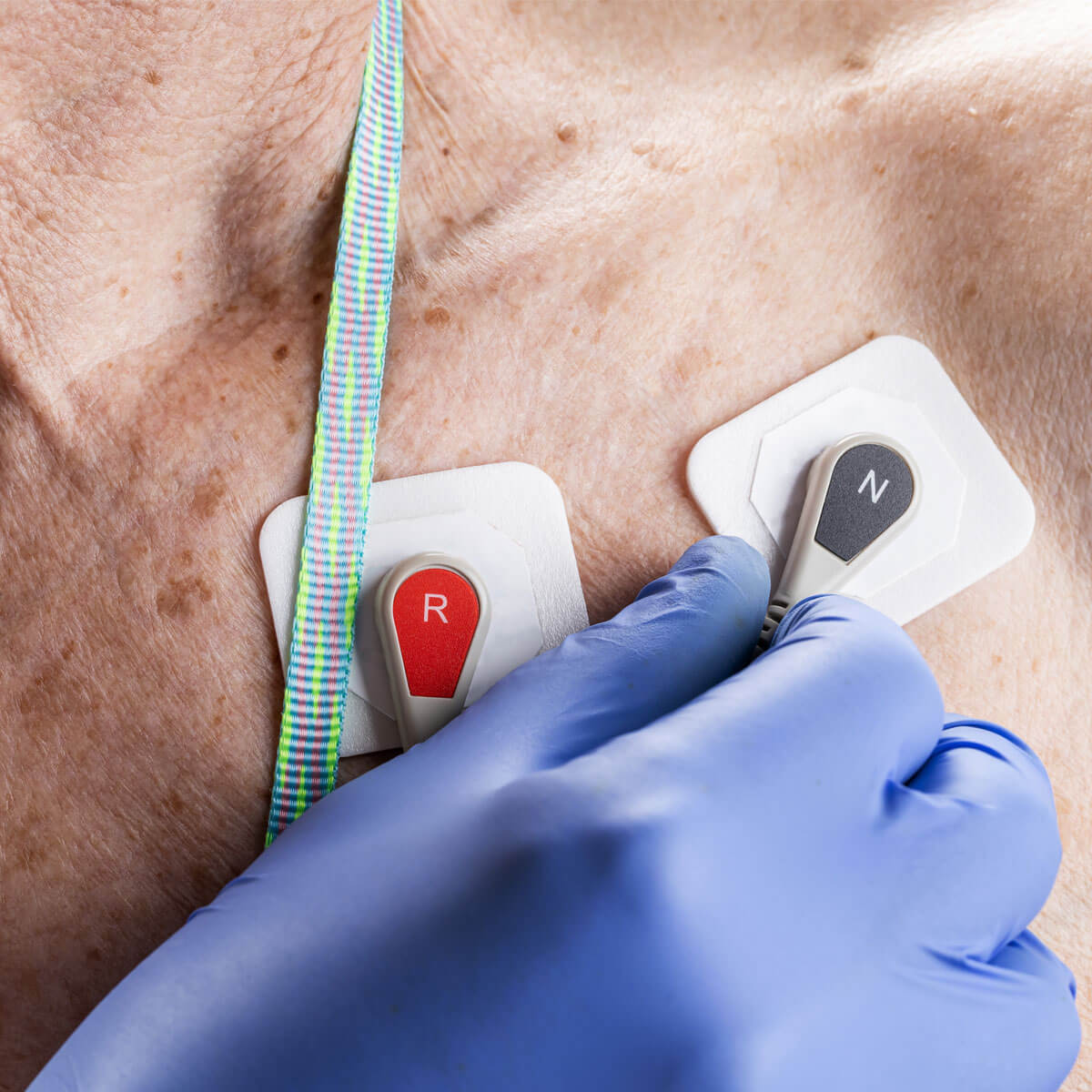 Quisisana PLDD - Decompressione laser percutanea del disco